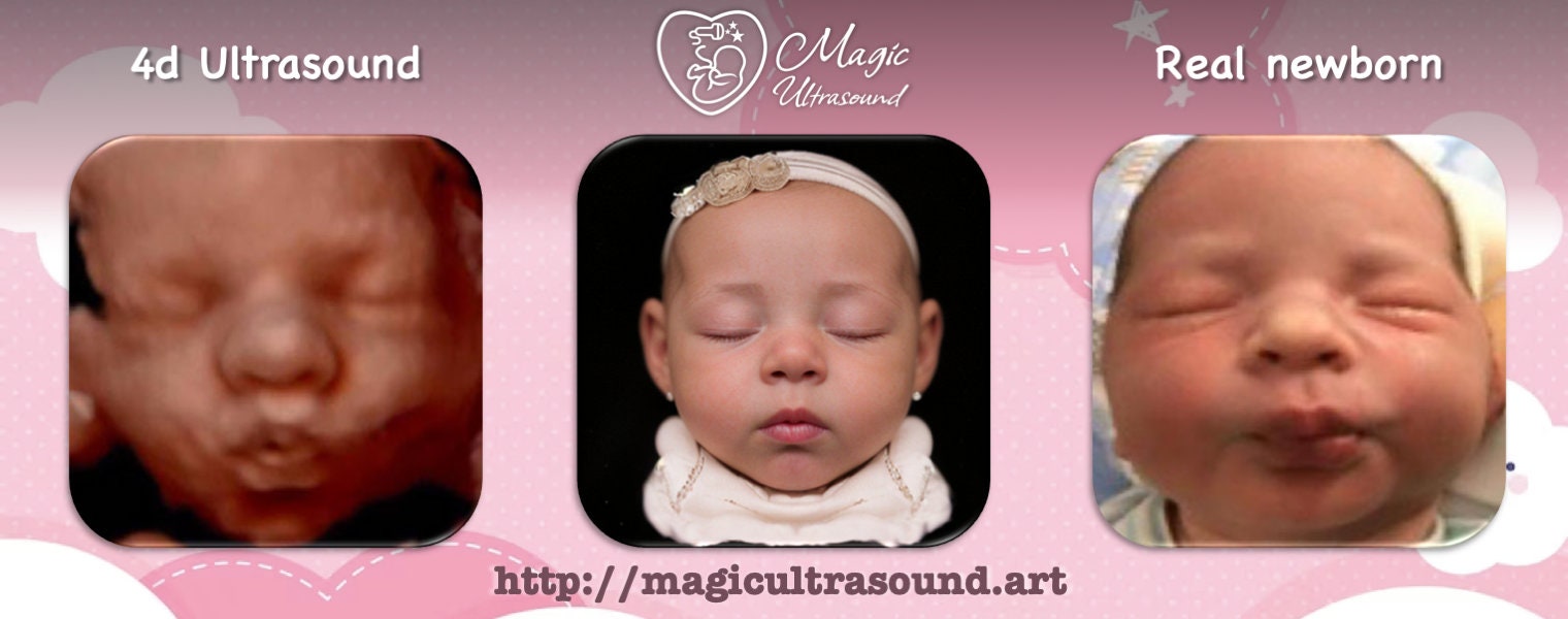 Animation of Your Unborn Baby Ultrasound Face | 8K Real View 3D/4D/5D ...