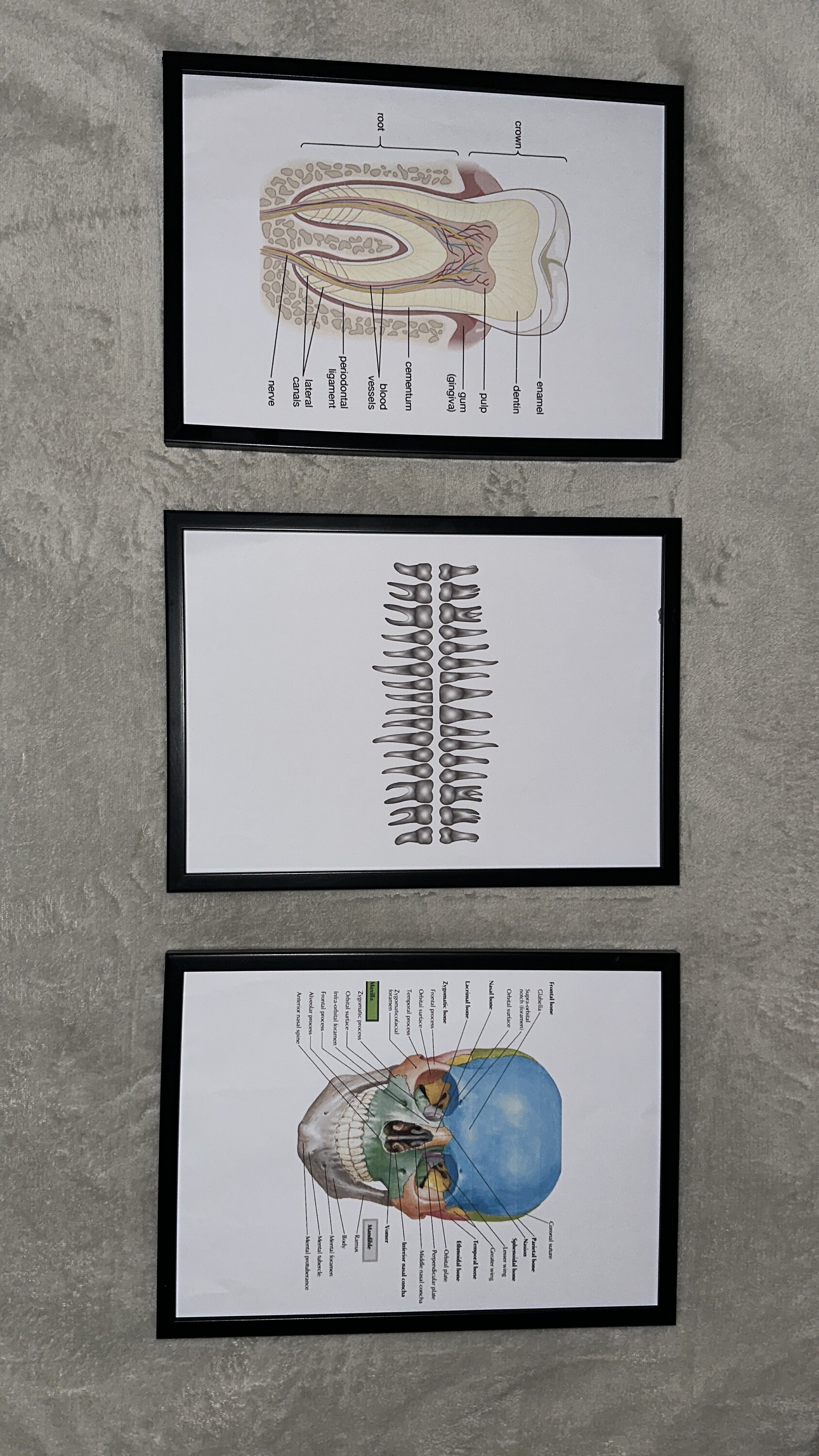 Dental Frames Dental Student Frames Dentist Dental - Etsy