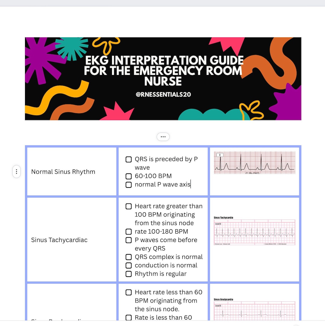 EKG/ Arrhythmias Guide for Emergency Room Nurse. Digital - Etsy