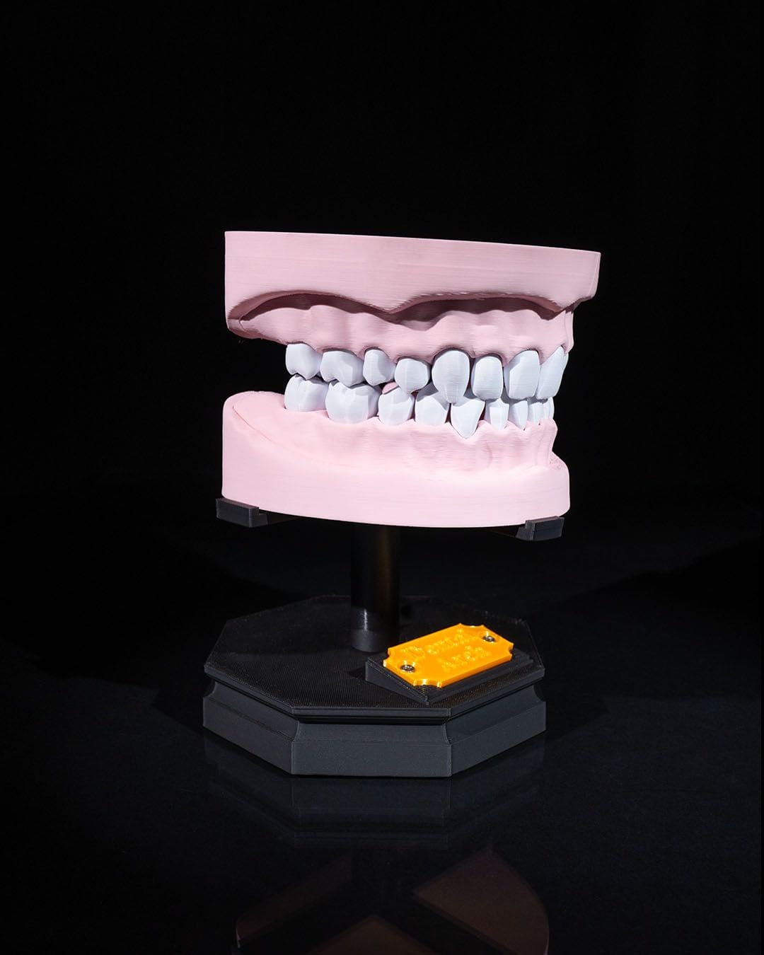 Upper and Lower Dental Arch - Etsy