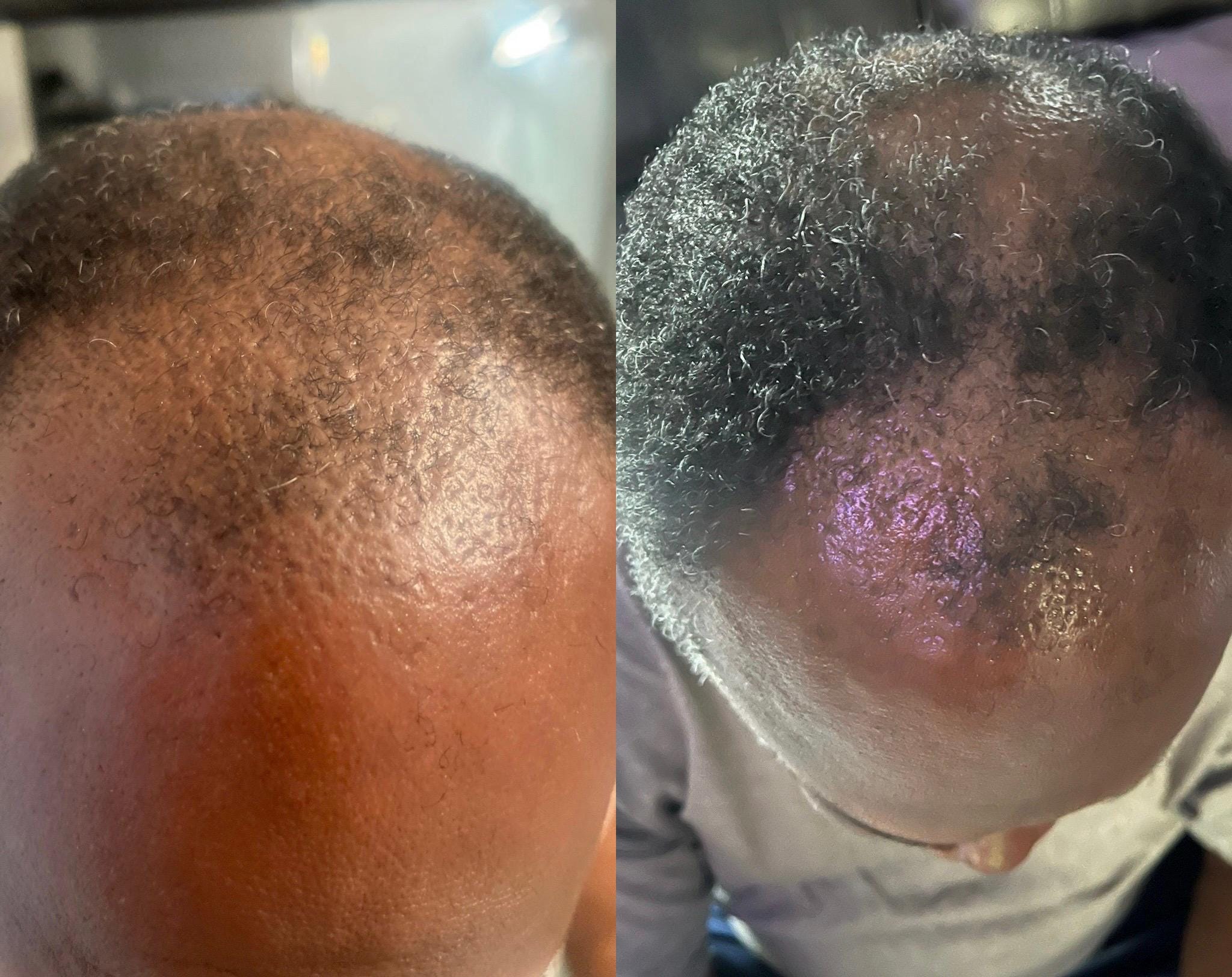 Miss Ree’s Hair Growth Oil - Etsy