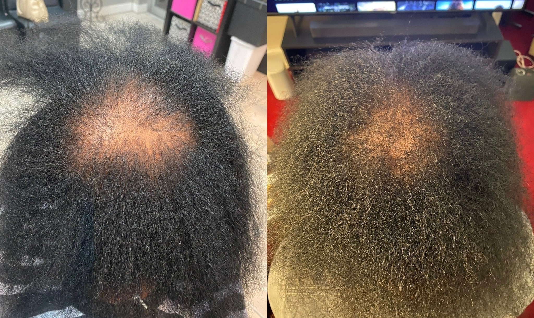 Miss Ree’s Hair Growth Oil - Etsy