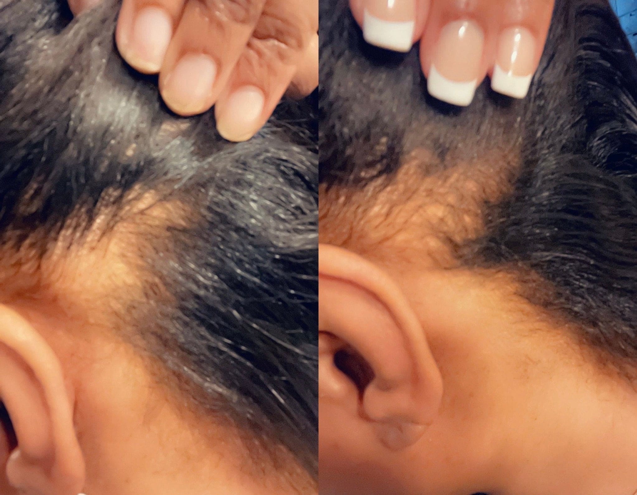 Miss Rees Hair Growth Oil - Etsy