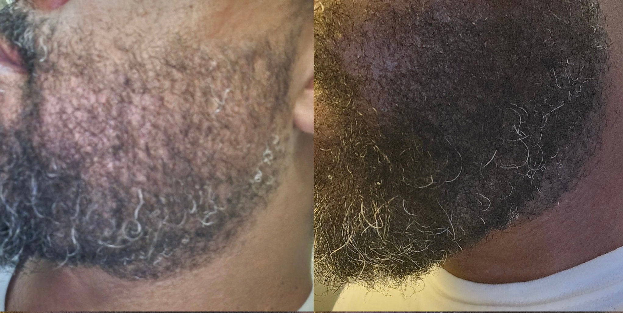 Miss Rees Hair Growth Oil - Etsy