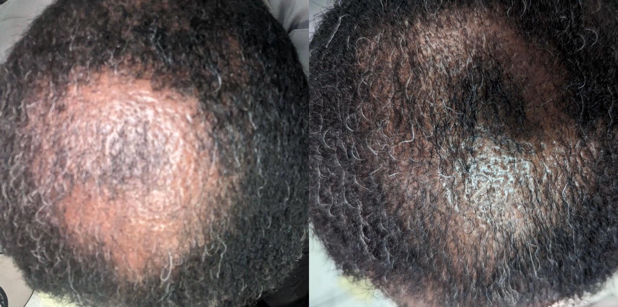 Miss Ree’s Hair Growth Oil - Etsy