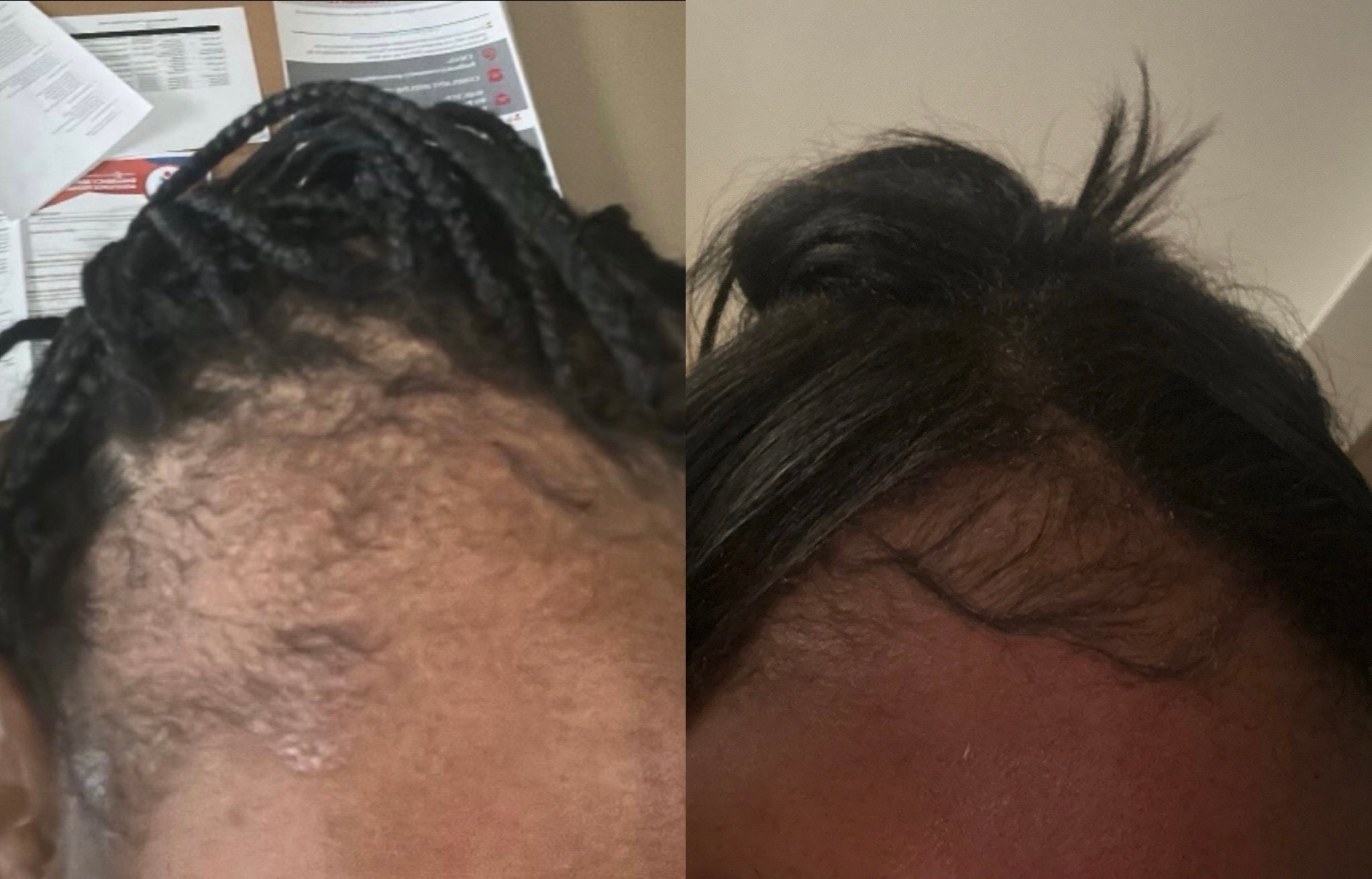 Miss Ree’s Hair Growth Oil - Etsy
