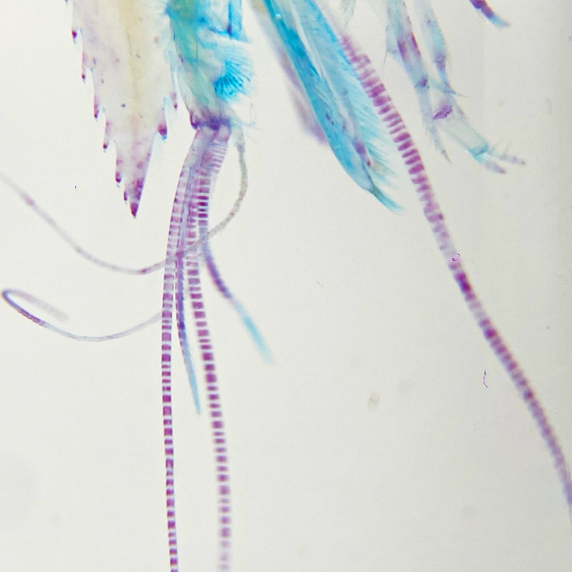 Mysterious Transparent Stained Skeleton Specimen,real Stained Specimen ...