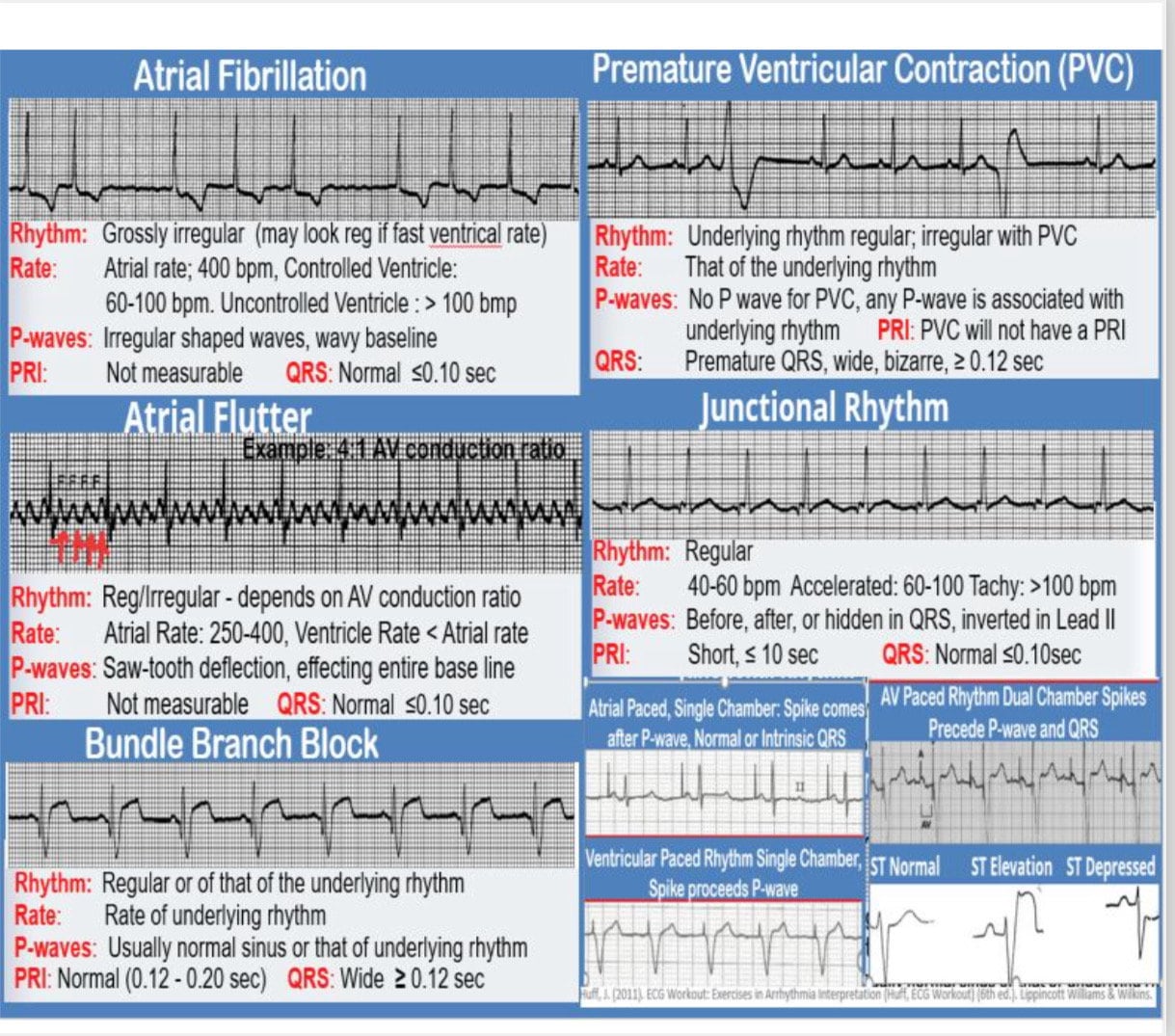 Hero's Ecg Ekg Analysis Quick Reference Badge Cards Use With Clip, Reel ...