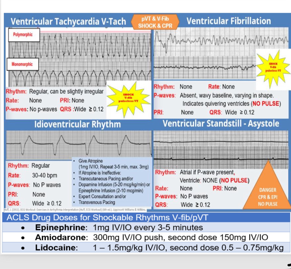 Hero's Ecg Ekg Analysis Quick Reference Badge Cards Use With Clip, Reel ...