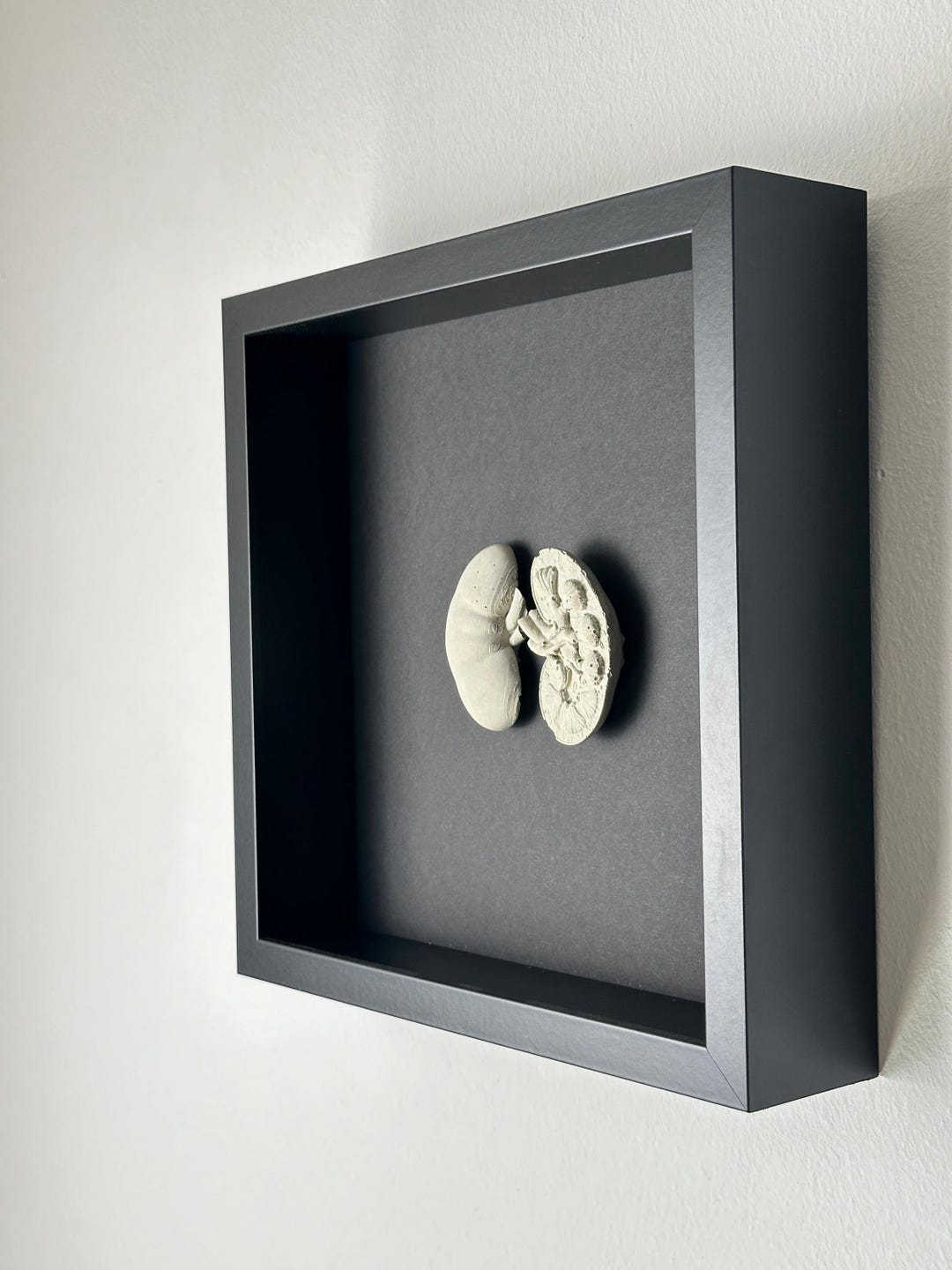 Handmade Anatomical Kidneys – Concrete Art for Medicine Lovers - Etsy