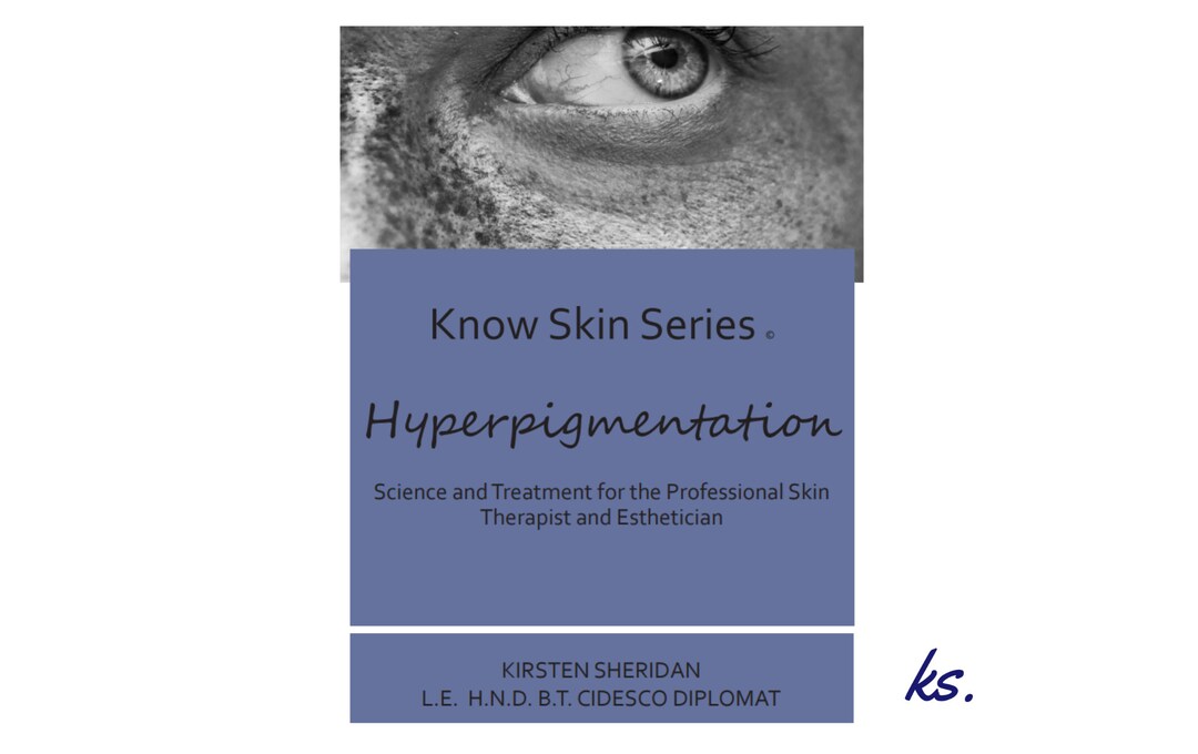 A Guide to Hyperpigmentation for Estheticians and Professional Skin ...