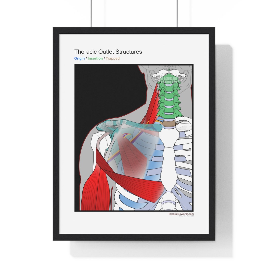 Thoracic Outlet Structures Dark Mode Matte Print Framed - Etsy