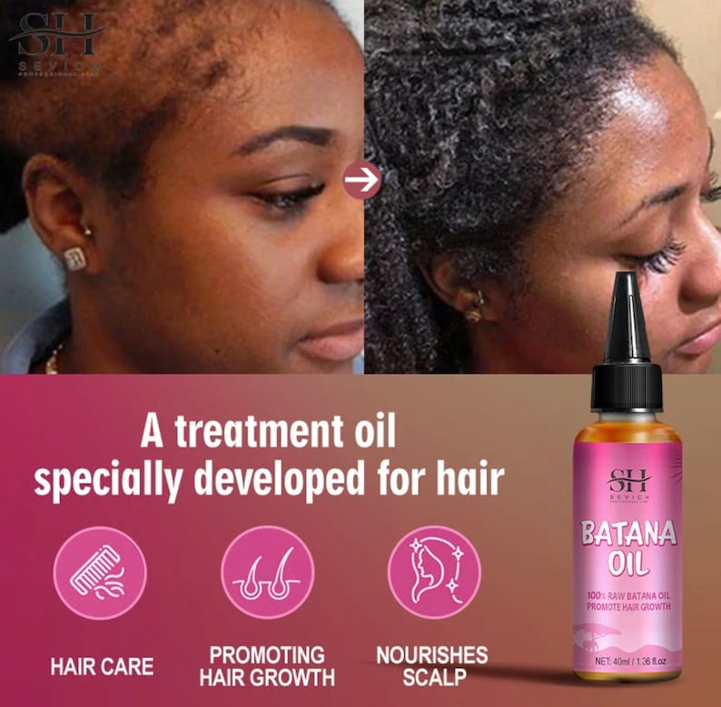 100% Raw Batana Oil From Honduras 40ml/1.36 Oz - Etsy