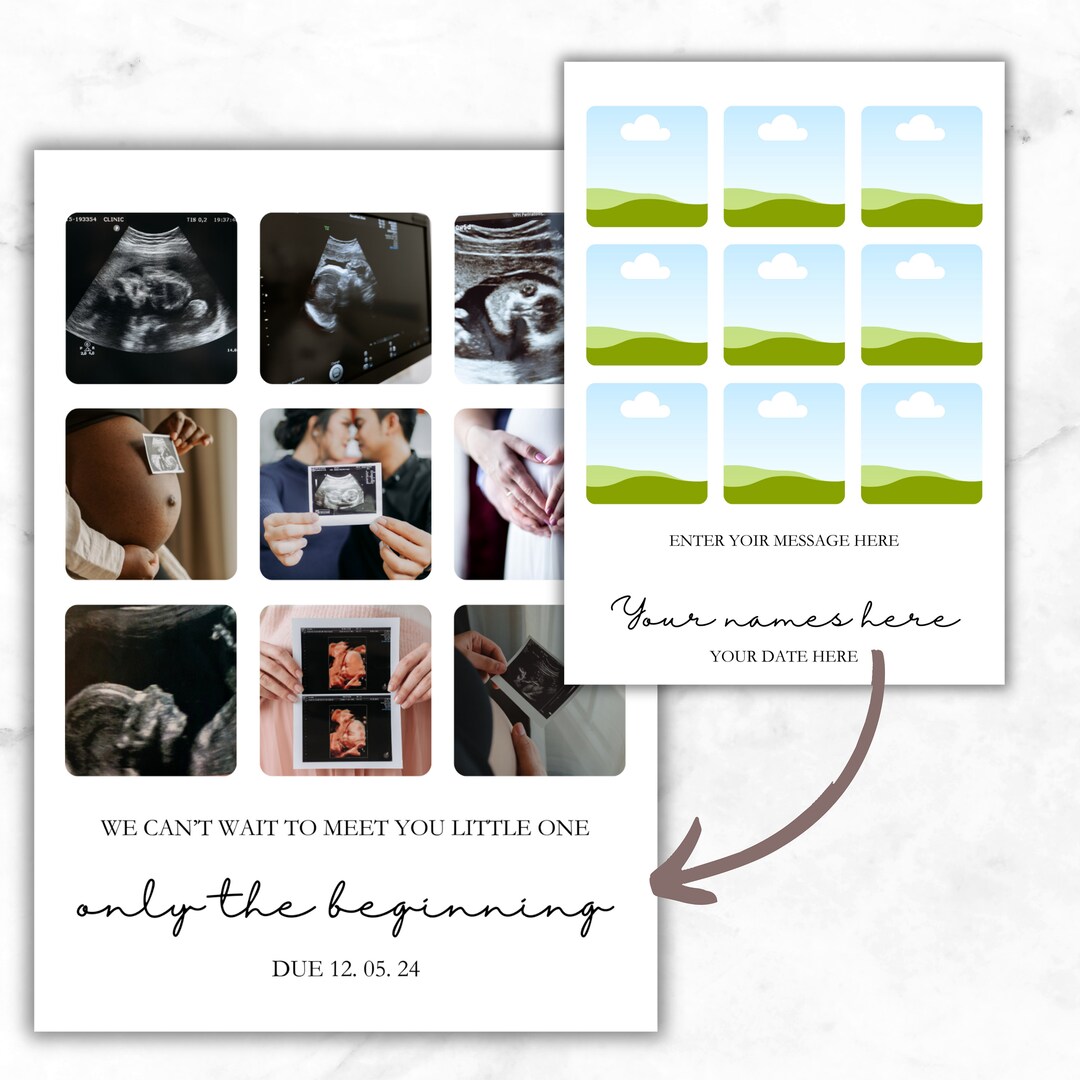 Baby Shower Sonogram Ultrasound Art for New Baby, Mothers Day Photo ...