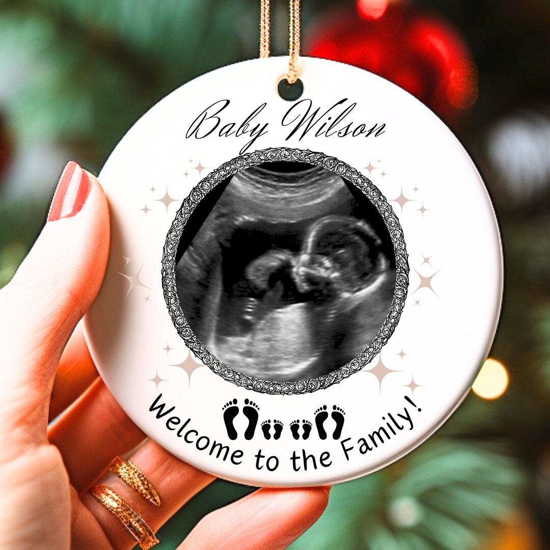 Custom Ultrasound Ornament, Personalized Expecting Ornament, Baby Scan ...