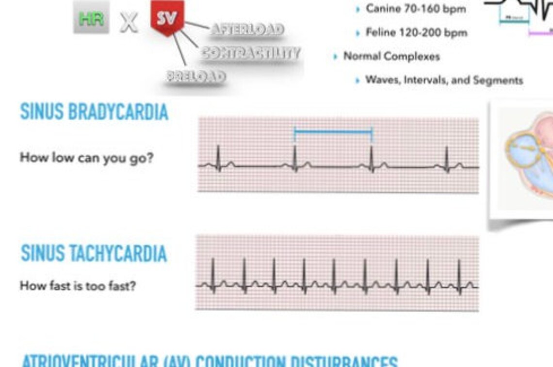 ECG Quick Reference Guide - Etsy