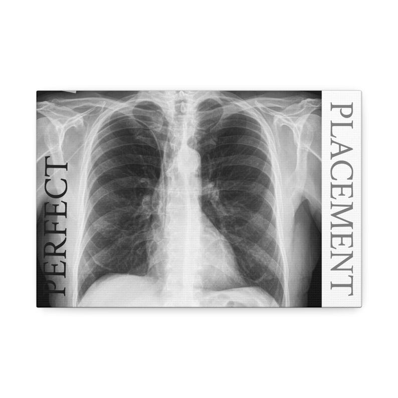 Chest X-ray Canvas Print, PICC Line, Medical Anatomy Art - Etsy