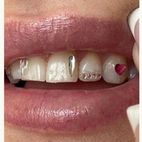 18k Gold Tooth Gems - Etsy