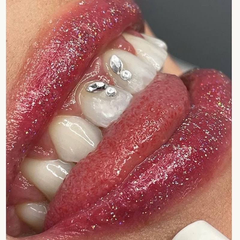 Teeth Gem Caps - Etsy UK