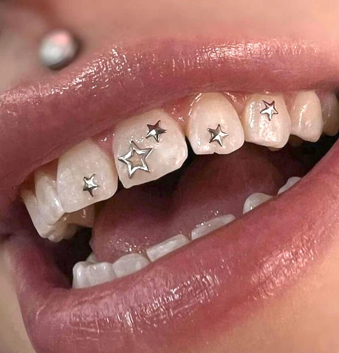 10pcs Tooth Gem Metal Silver Plated Rounded Star Metal 3mm Flatback ...