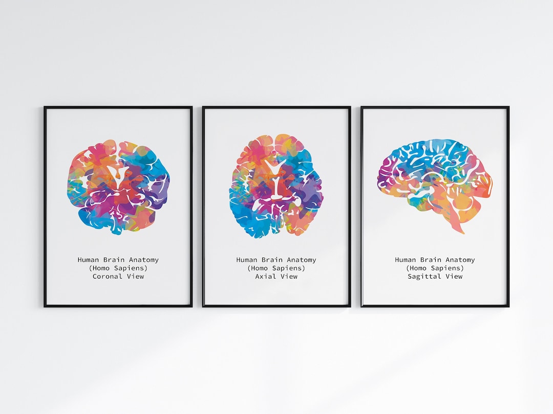 Human Brain Art, Axial, Coronal, Sagittal Sections View, Neuroscience ...