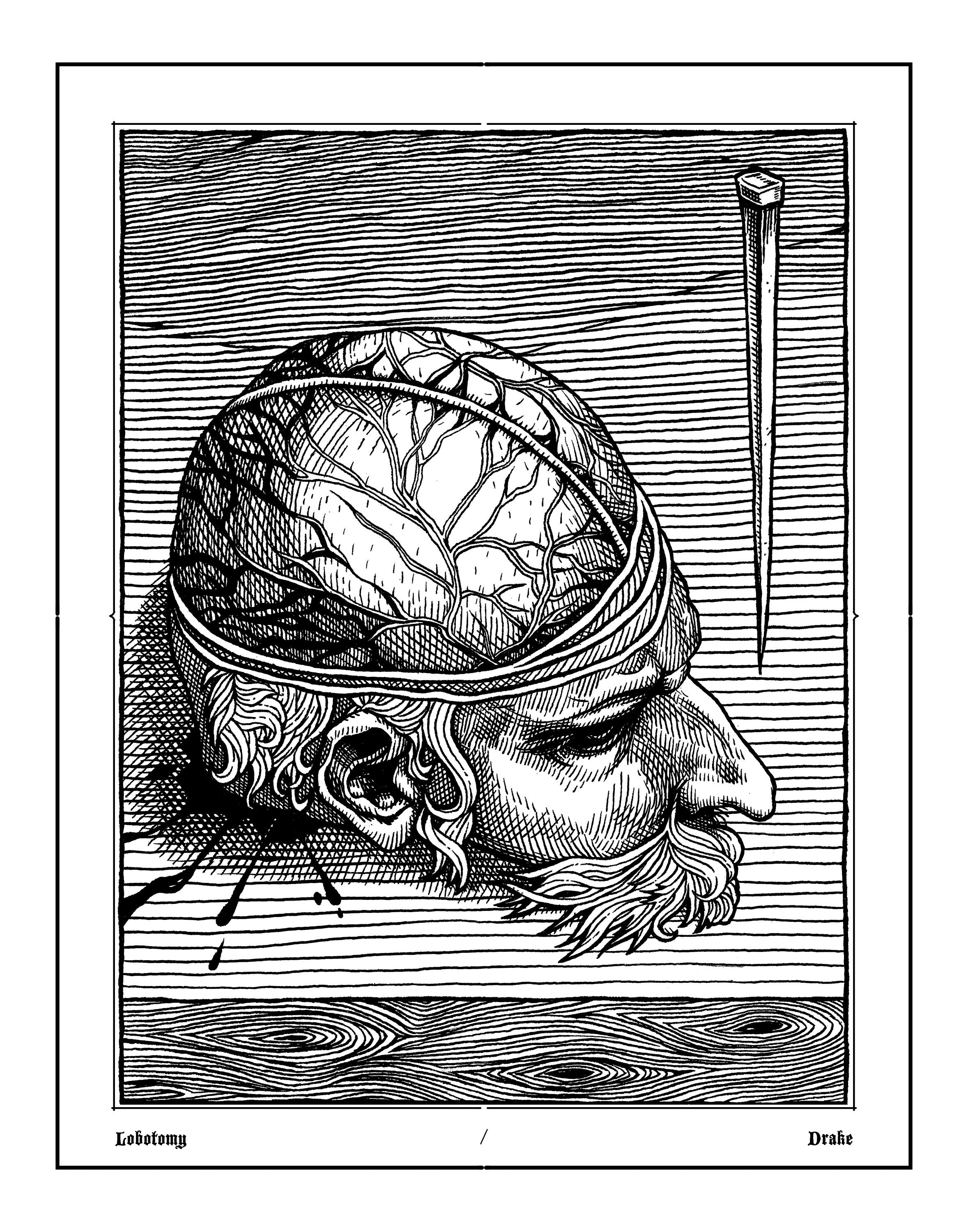 Lobotomy Print - Etsy