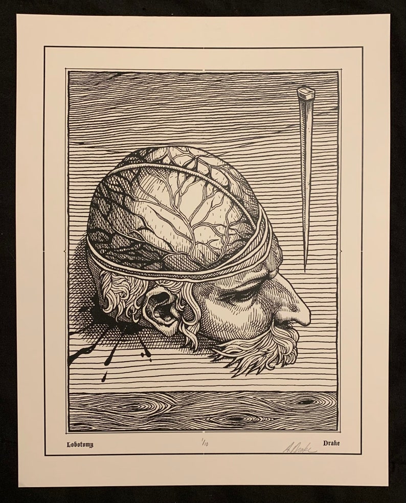 Lobotomy Print - Etsy