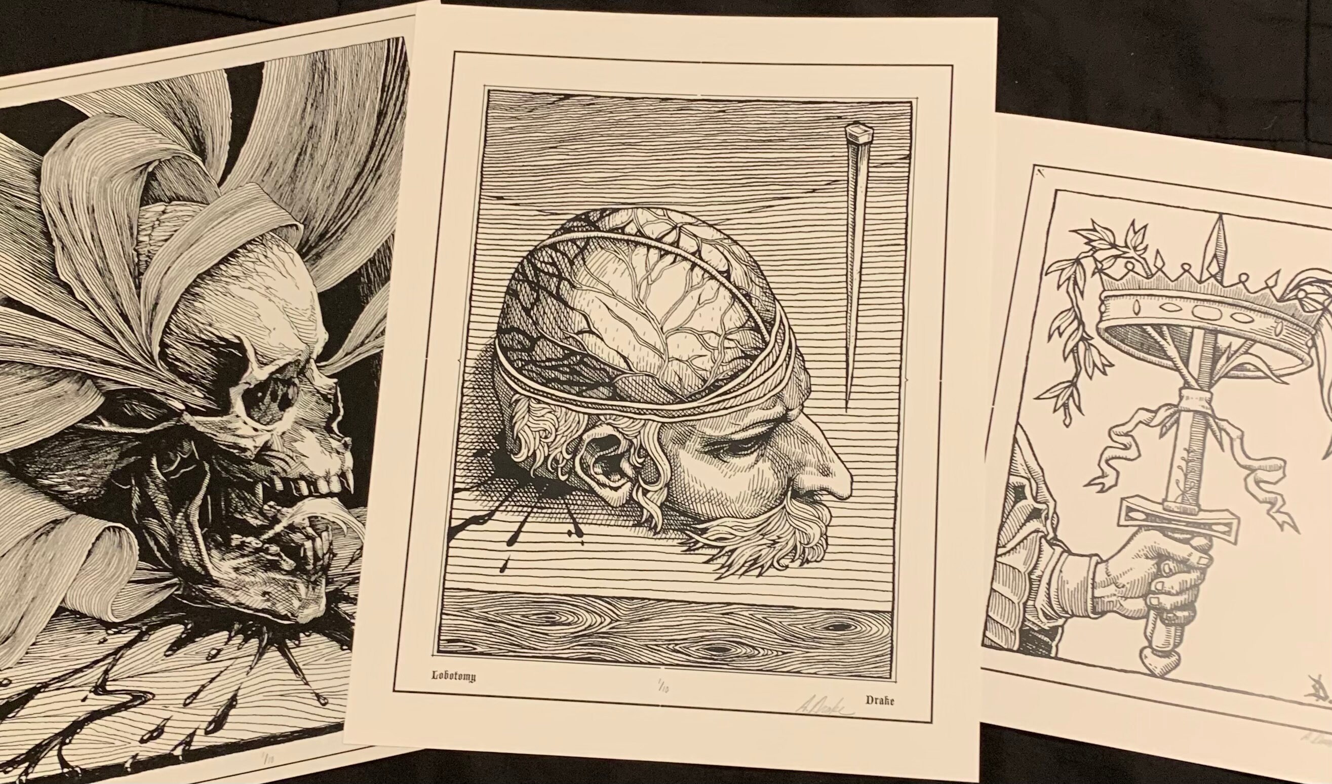 Lobotomy Print - Etsy