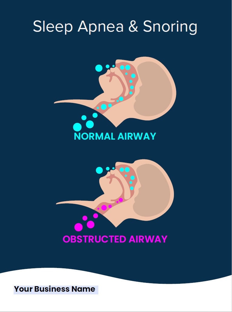 Fillable Sleep Apnea Airway Poster 18x24 Size - Etsy