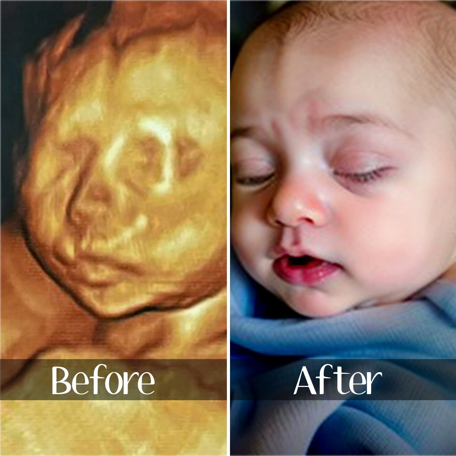 8K Enhanced Baby Ultrasound Perfect Baby Shower Surprise and Ultrasound Gift, From Bumps to ...