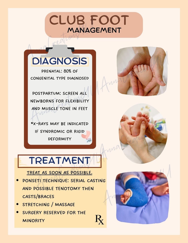 Club Foot Congenital Condition, Postpartum, Prenatal, Newborn, Infant ...