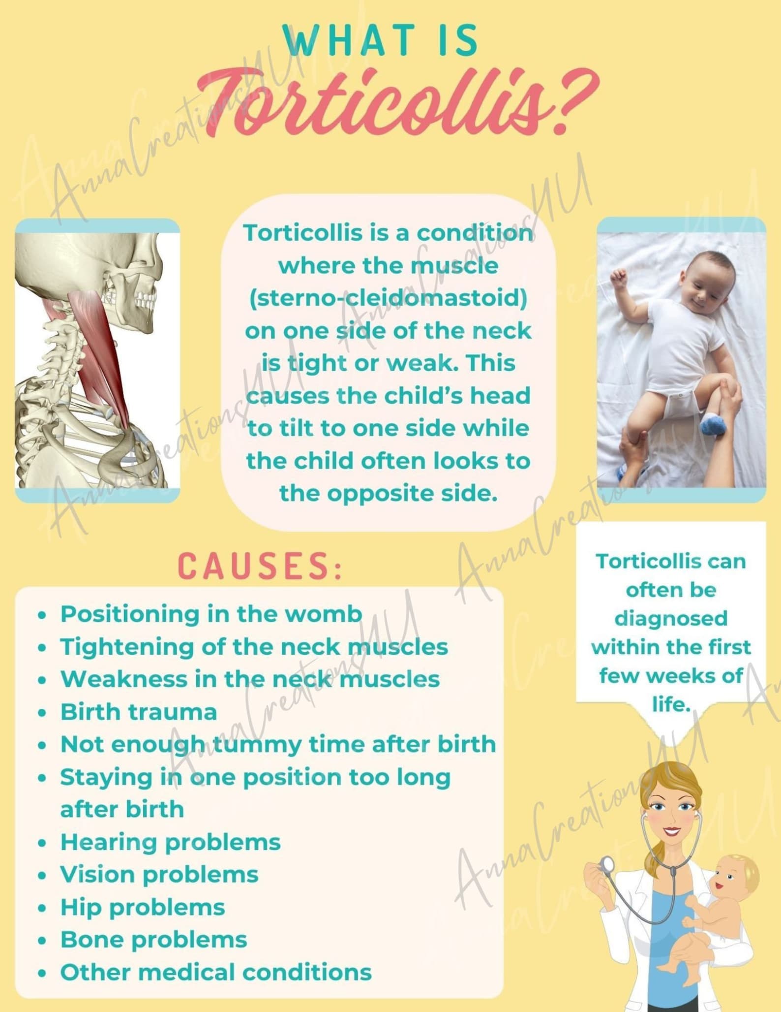 Torticollis Handout for Parents, Caregivers, Medical Professionals, Day ...