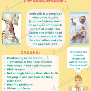 Torticollis Handout for Parents, Caregivers, Medical Professionals, Day ...