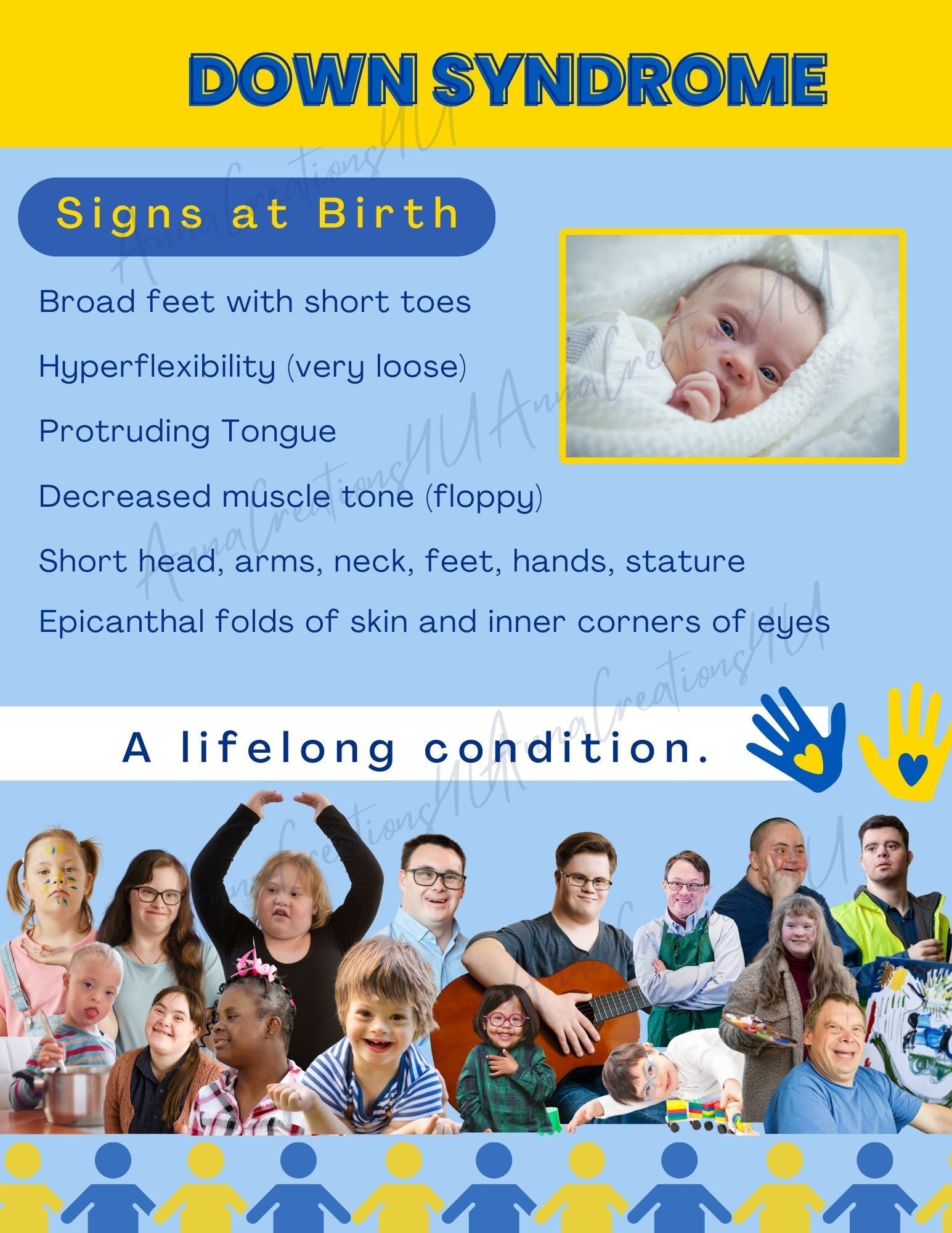 Management Down Syndrome Education Handout, Parent, Patient, Teacher ...