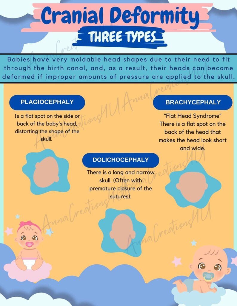 Cranial Deformities, Plagiocephaly, Brachycephaly, Torticollis, Wry ...