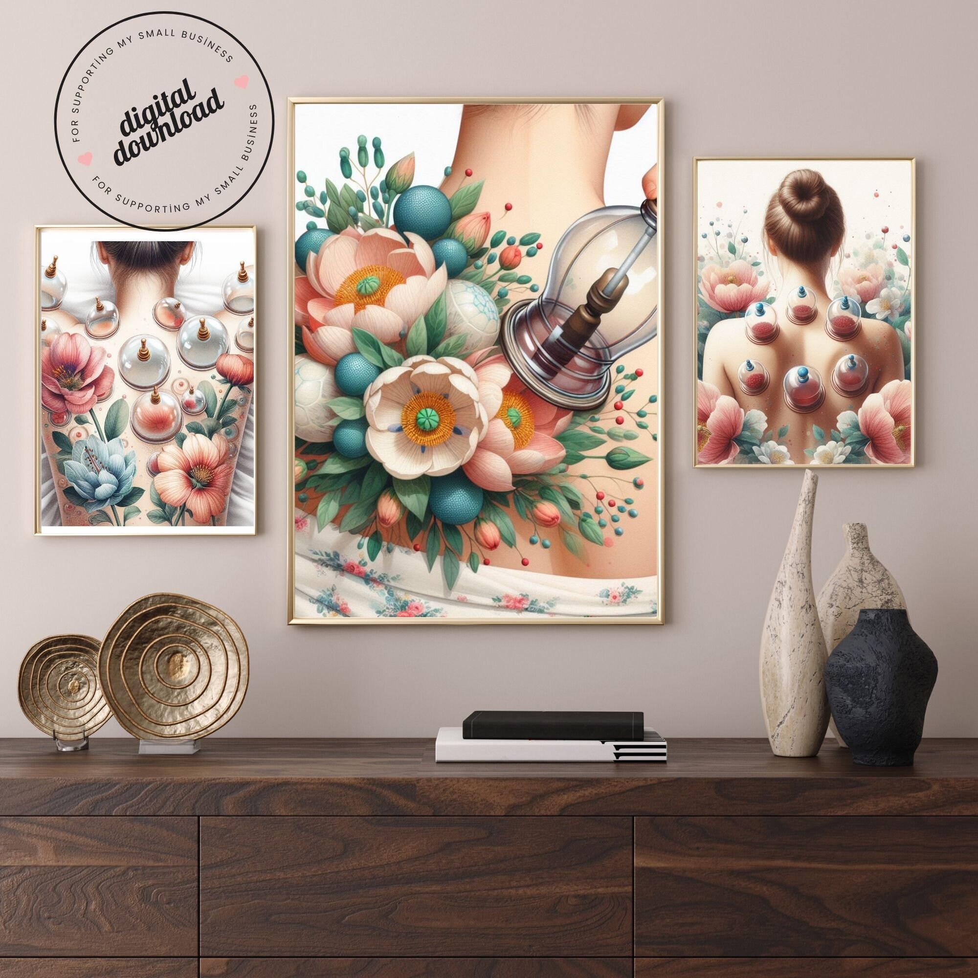 Cupping Therapy Artwork, Cupping Therapy, Vacuum Cupping Print ...