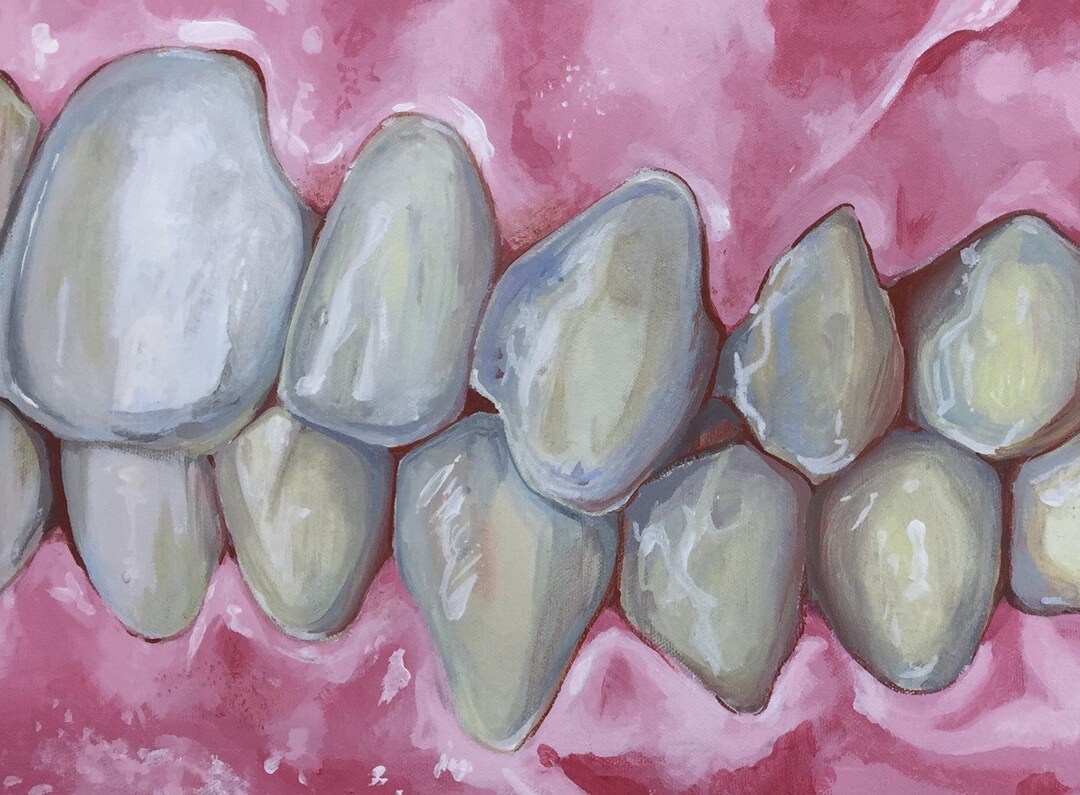 Teeth and Gums -- Postcard Print - Etsy