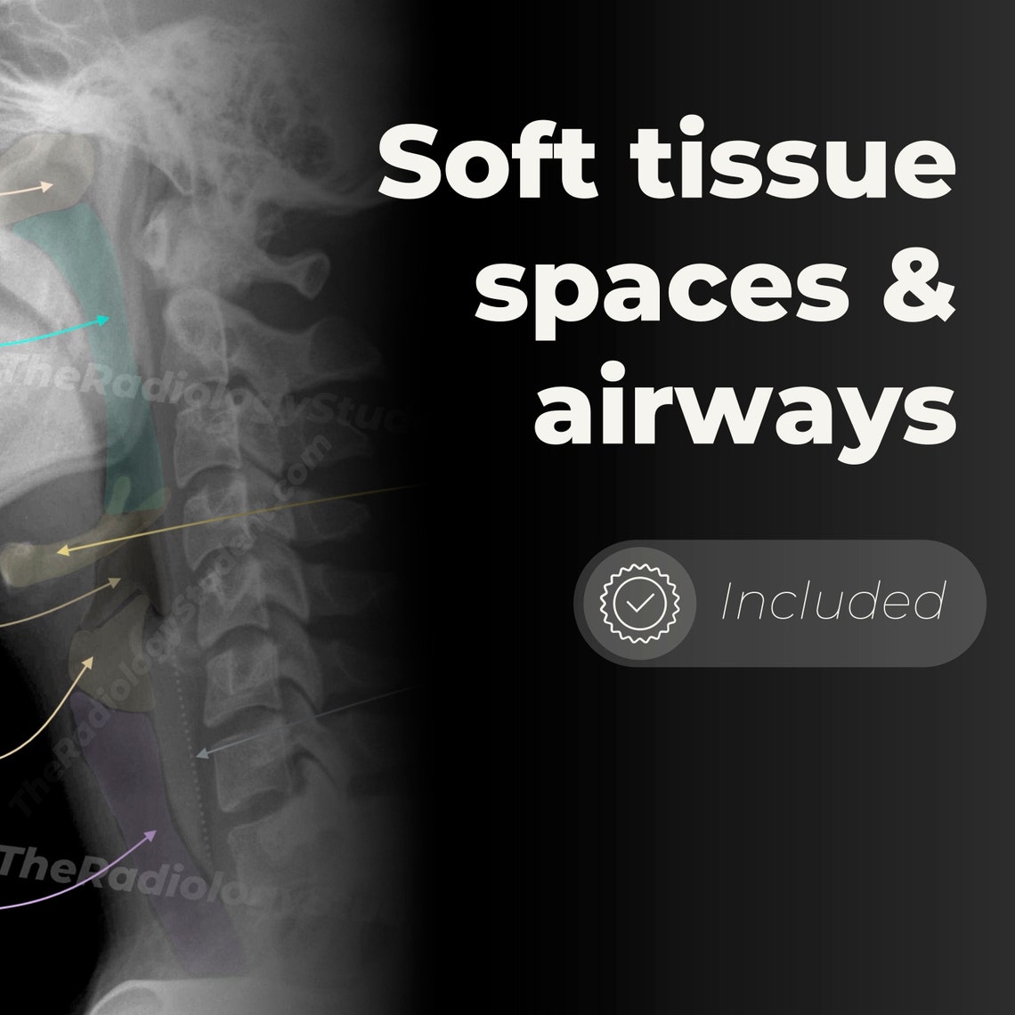 Cervical Spine X-ray Anatomy Quiz | Diagnostic Radiology Study Guide ...