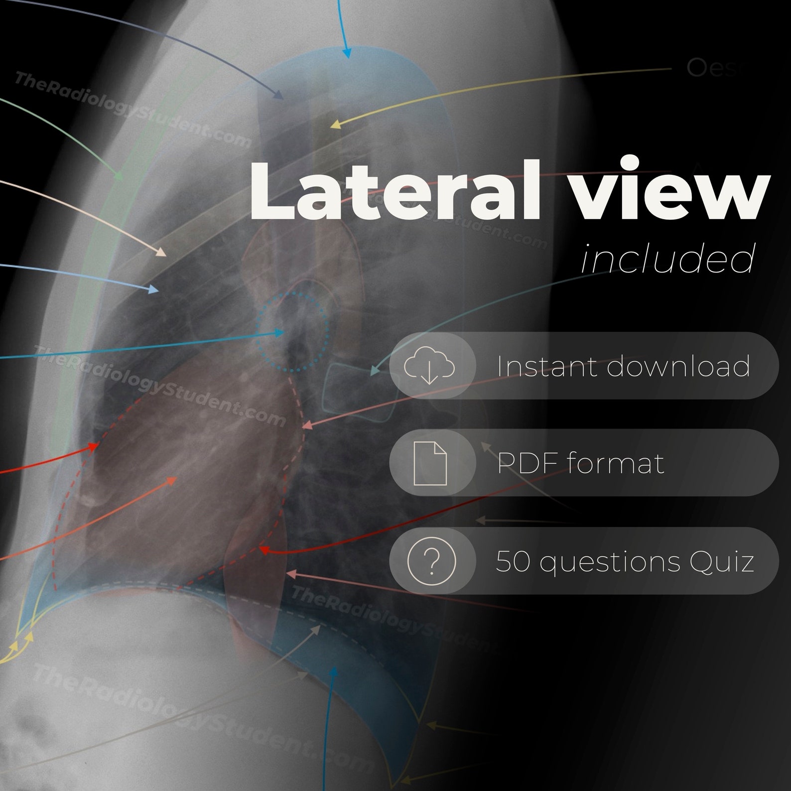 Chest X-ray Anatomy | Labelled Radiography Notes - Etsy