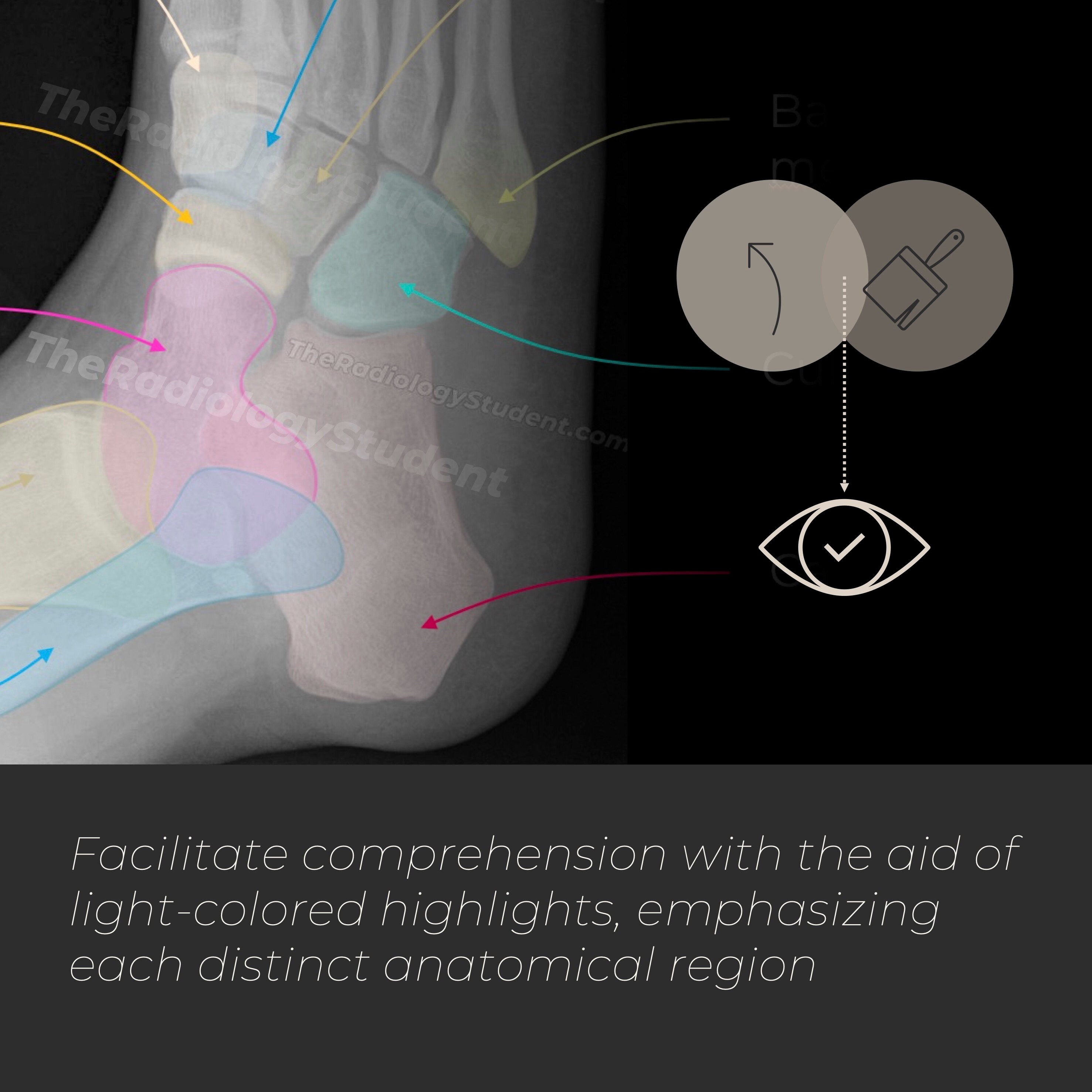 Foot Radiography Anatomy Radiology Study Aid for Beginner Annotated X ...