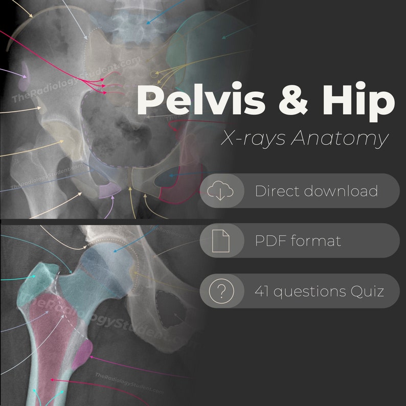Pelvis & Hip Xray Anatomy Quiz | Study Material for Radiology Technicians or Med Student - Etsy