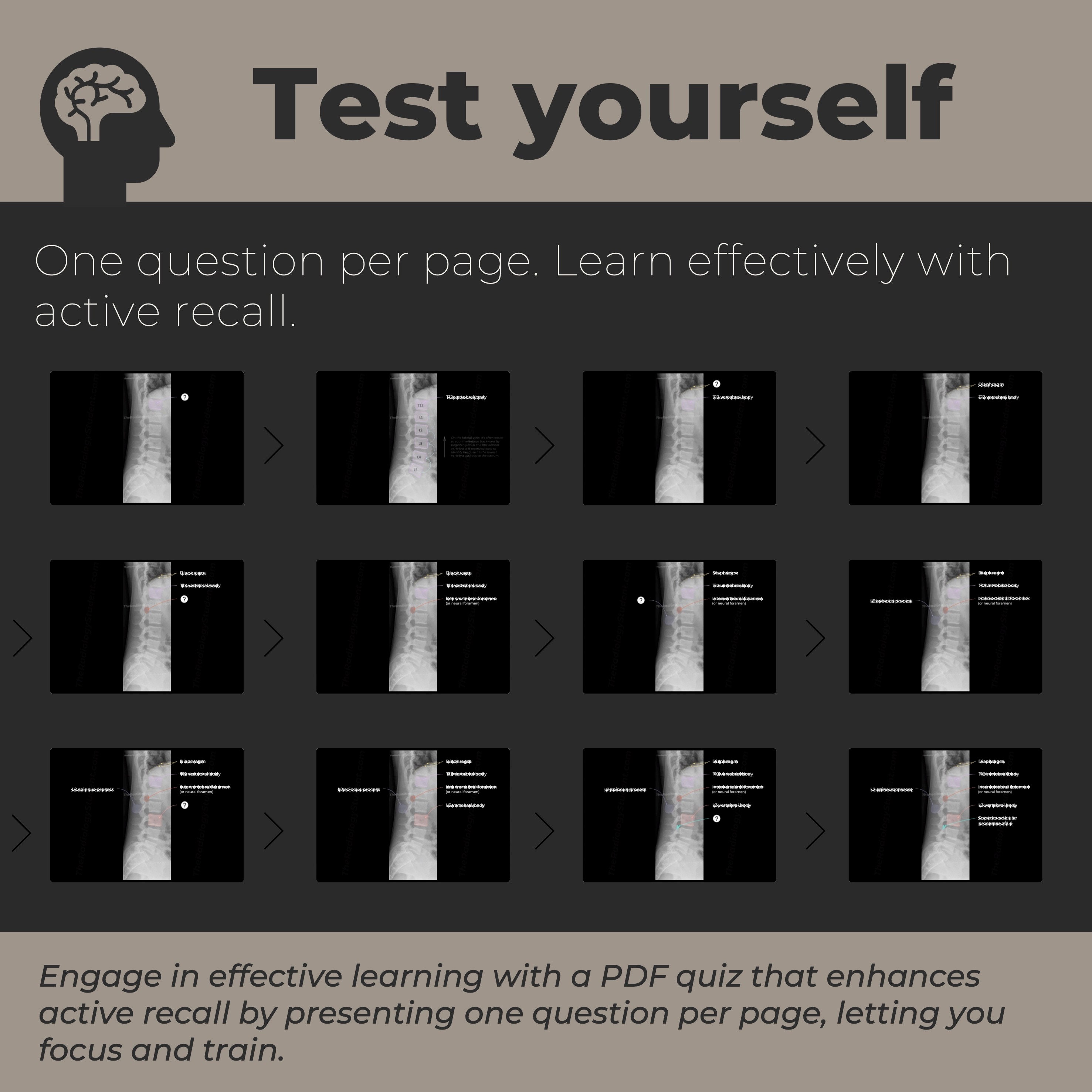 Lumbar Spine Radiology Note | Annotated X-ray Quiz to Learn Radiology ...