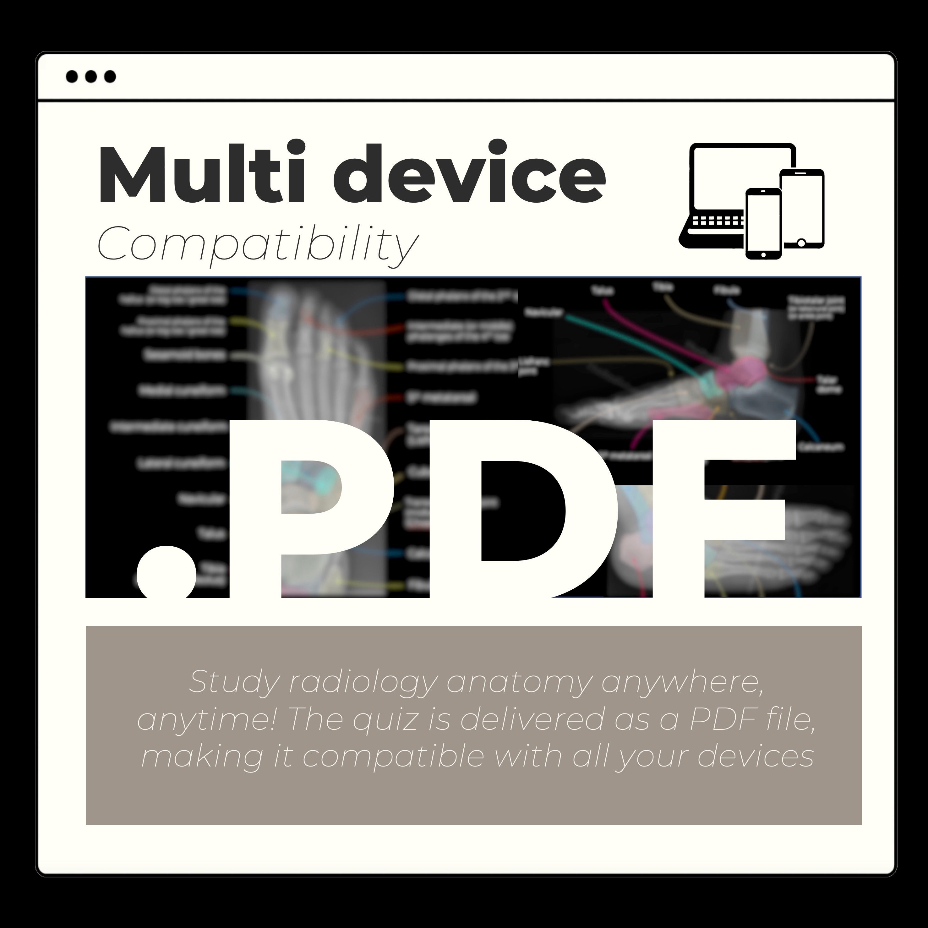 Foot Radiography Anatomy Radiology Study Aid for Beginner Annotated X ...