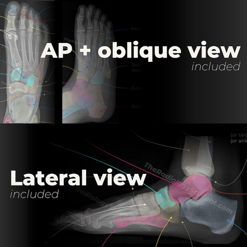Foot Radiography Anatomy | Radiology Study Aid for Beginner | Annotated ...