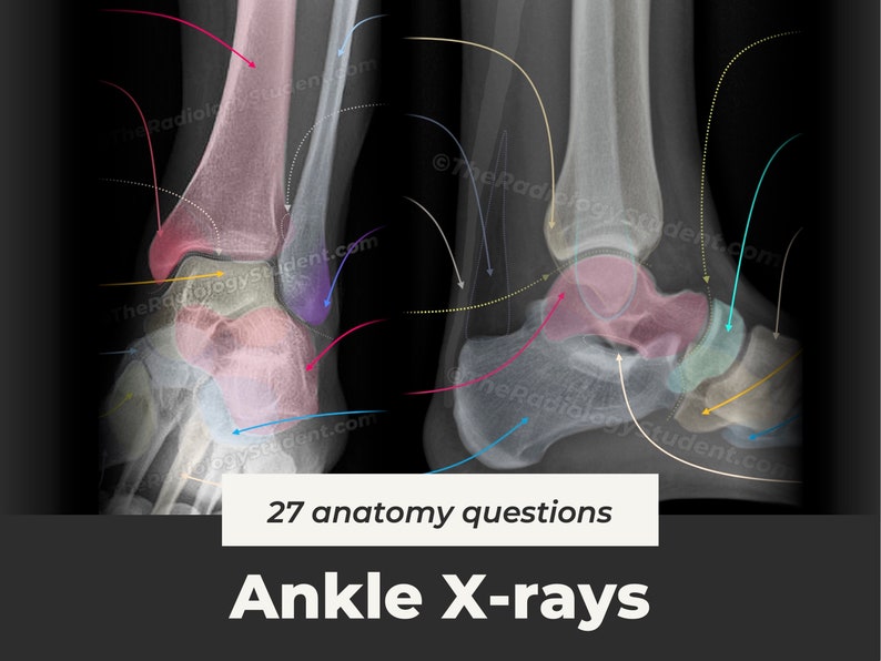 Ankle Xrays Annotated - Labeled Quiz to Learn Radiology Anatomy - Etsy ...