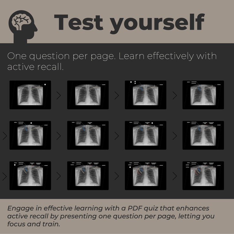 Chest X-ray Anatomy | Labelled Radiography Notes - Etsy