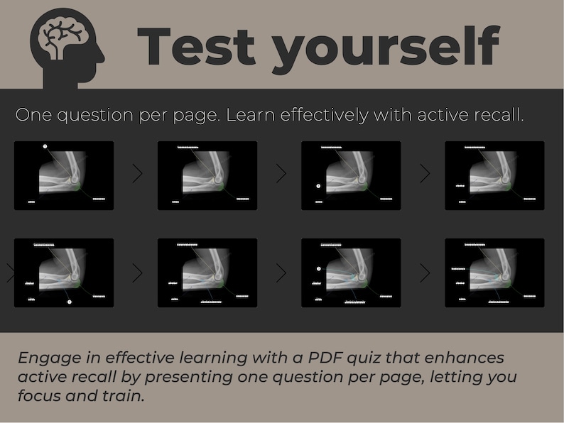 Elbow X-ray Anatomy | Radiology Study Guide for Rad Tech - Etsy