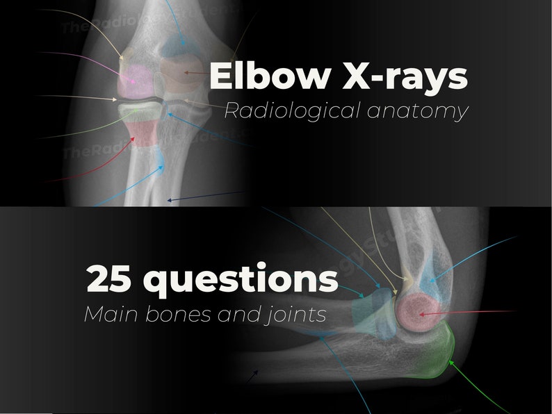 Elbow X-ray Anatomy | Radiology Study Guide for Rad Tech - Etsy