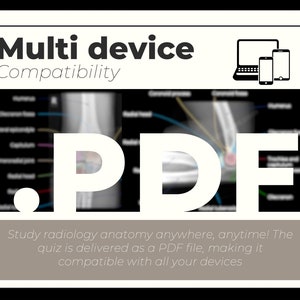 Elbow X-ray Anatomy | Radiology Study Guide for Rad Tech - Etsy