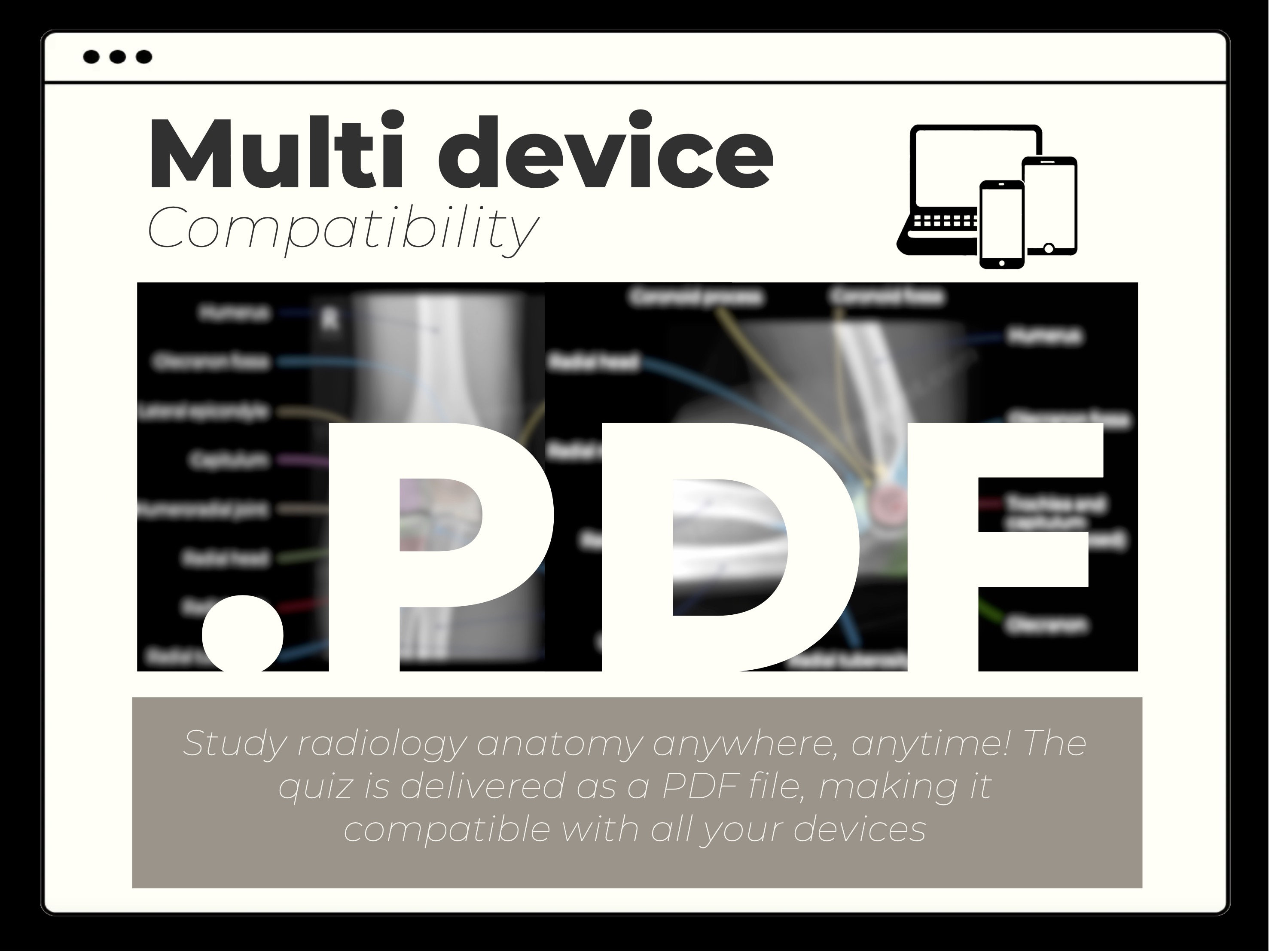 Elbow X-ray Anatomy | Radiology Study Guide for Rad Tech - Etsy